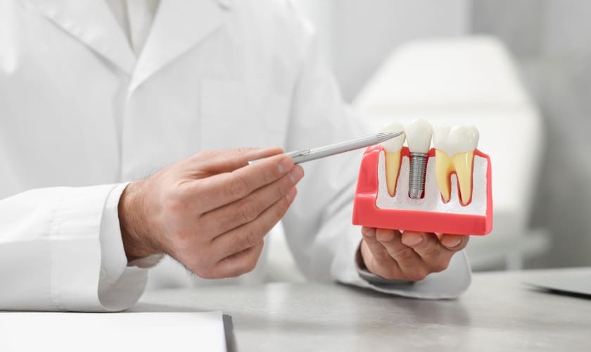 The Golden Rules of Dental Implant Care